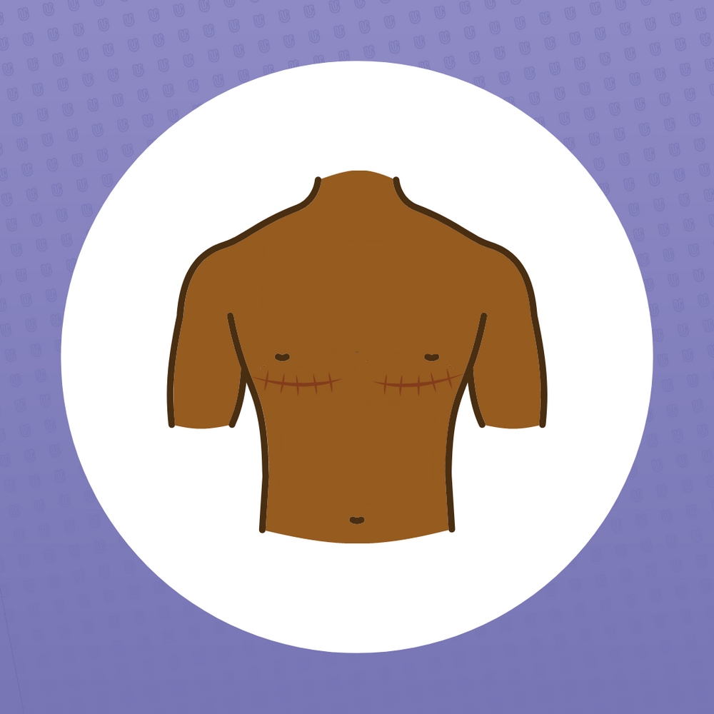 Everything You Need To Know About FTM Top Surgery